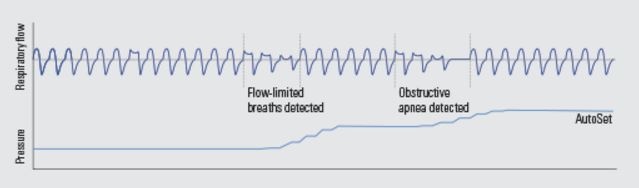 What is an automatic positive airway pressure (APAP) machine?