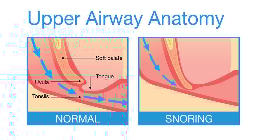 Why Do People Snore? Reasons, Risks, & Treatment Options