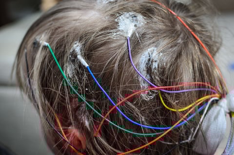 What is a sleep study (polysomnography)?