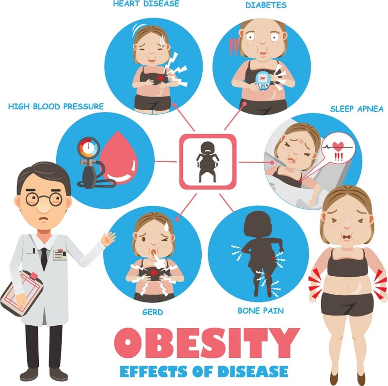 Obesity and Sleep Apnea: Risks, Causes, and Effects