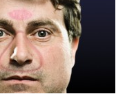 CPAP Con Spotlight: Sinus infections, rainout, gassiness, facial marks